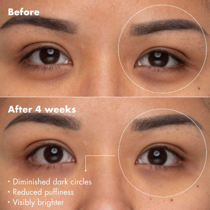 OAM Vitamin C Eye Revitalizer – OAM skin